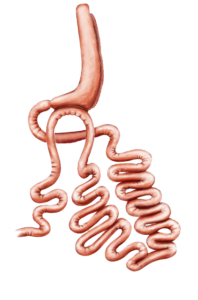 SASI-S Weight Loss Surgery Perth | Dr Kevin Dolan