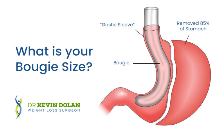 Does bougie size matter? - Dr Kevin Dolan